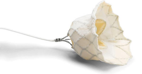 Abbotts Tendyne erhält weltweit erste CE- Kennzeichnung - Systeme ...