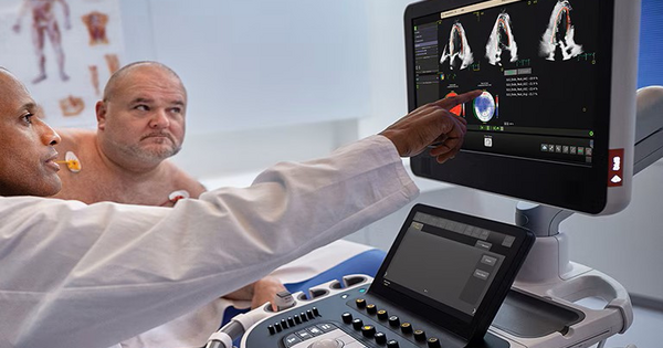 Herz-Ultraschall: Philips integriert mehr KI ins Echokardiogramm - E ...